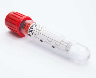 Blood Collection Tube - Plain Tube | RAY INTEGRATED MEDICALS